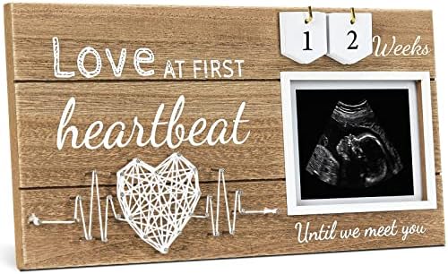 Amazon.com: YelloIris Ultrasound Picture Frames with Milestone Tracker ...