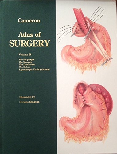 Atlas of Surgery: The Esophagus, the Stomach, the Duodenum, the Spleen ...
