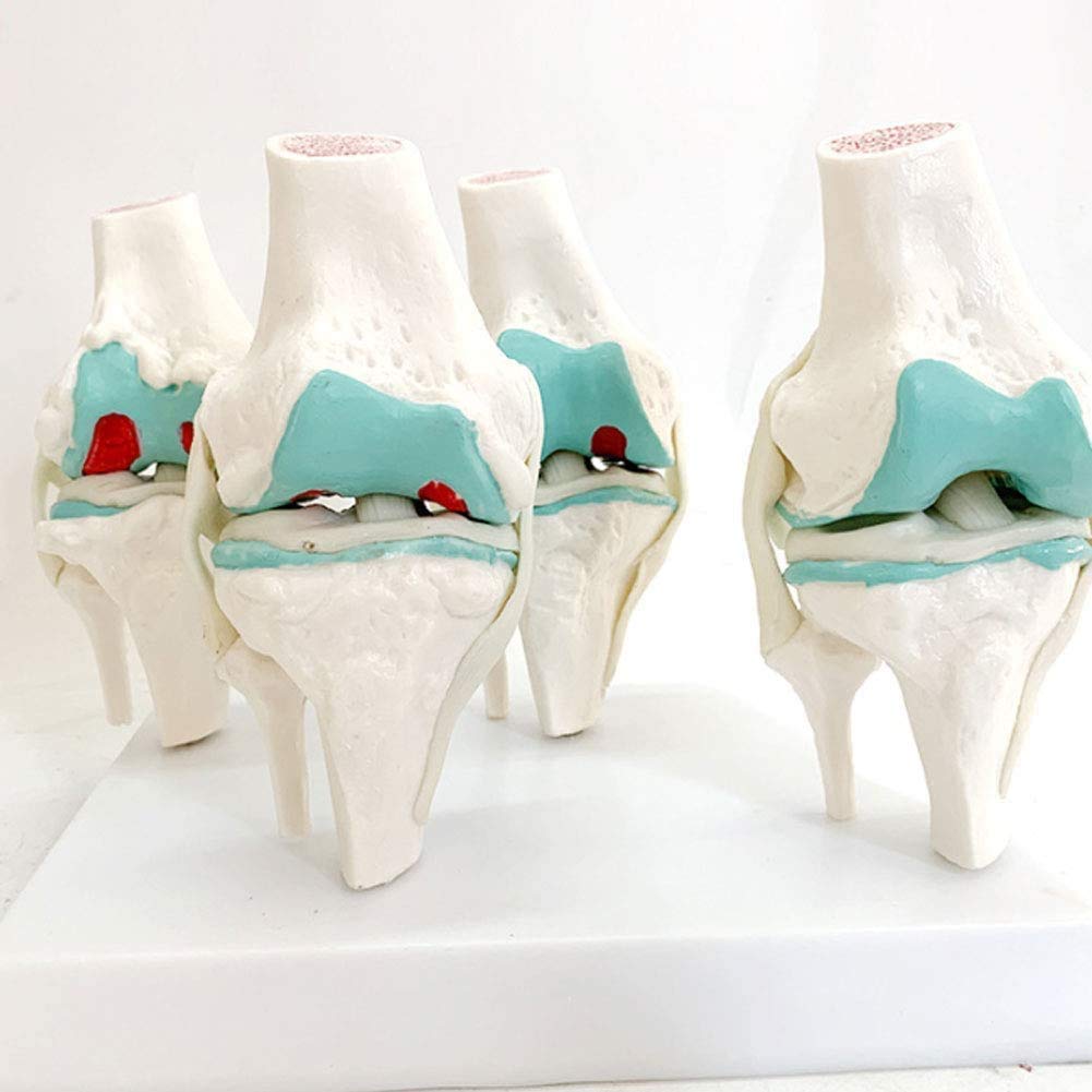 Dfju Education A Model Of The Knee Joint The Knee | Desertcart Thailand
