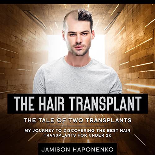 Amazon.com: The Hair Transplant: The Tale of Two Transplants: My ...
