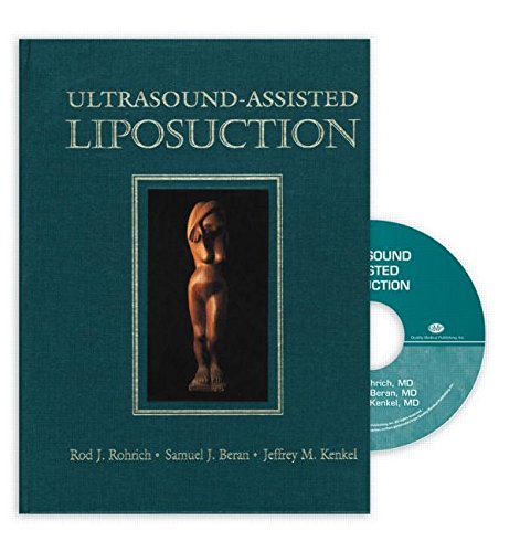 Ultrasound-Assisted Liposuction: 9781576261095: Medicine & Health ...