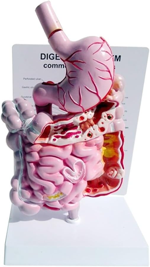 Human Digestive System Model, Gastrointestinal Tract Australia | Ubuy
