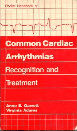 Pocket Handbook of Common Cardiac Arrhythmias: Recognition and ...