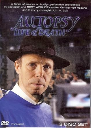 Amazon.com: Autopsy: Life or Death : Gunther von Hagens: Movies & TV