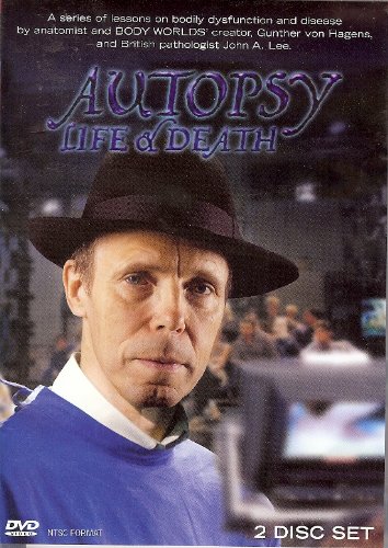 Amazon.com: Autopsy: Life or Death : Gunther von Hagens: Movies & TV