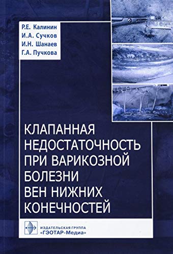 Amazon.com: Klapannaya nedostatochnost pri varikoznoy bolezni ven ...