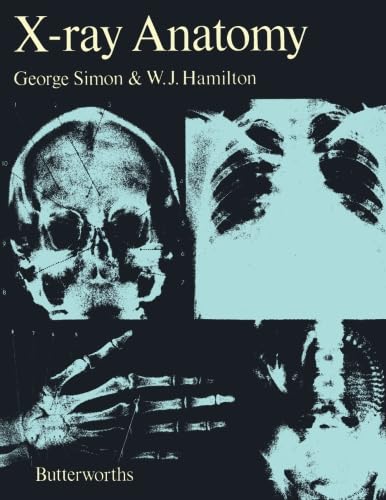 X-Ray Anatomy: Simon, George: 9781483249018: Amazon.com: Books