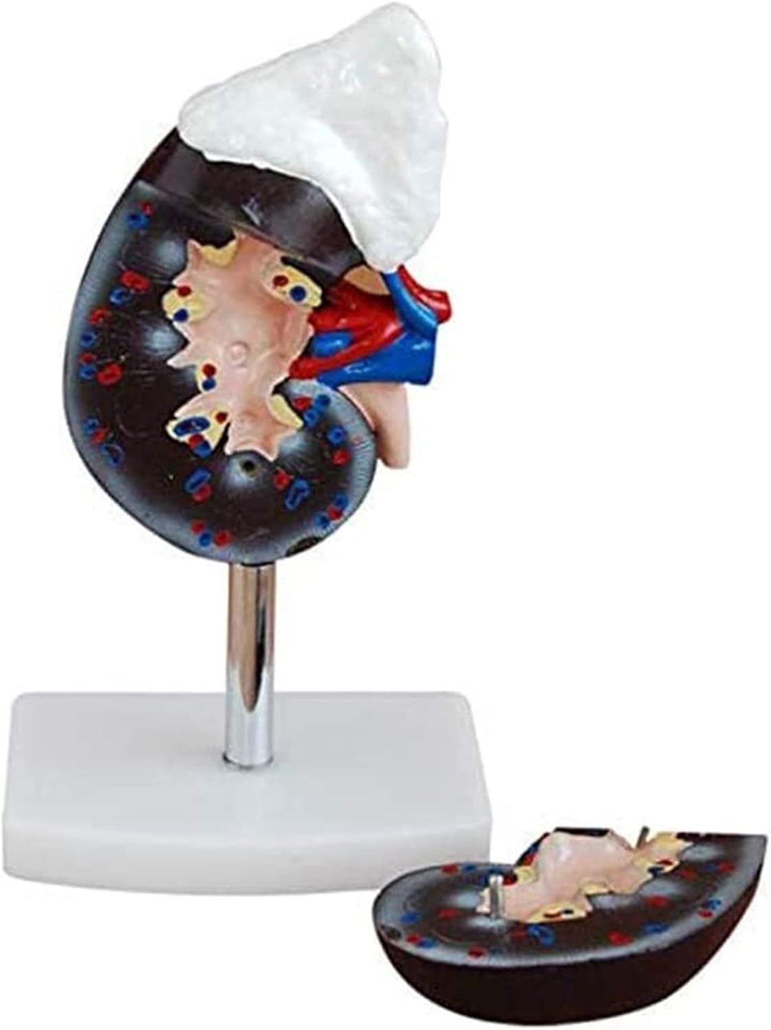 Modelo De AnatomíA De EnseñAnza, Anatomía renal con glándula ...