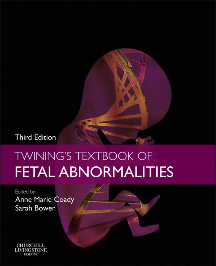 Twining's Textbook of Fetal Abnormalities: Twining's Textbook of Fetal ...