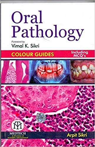 Buy Oral Pathology Book Online at Low Prices in India | Oral Pathology ...