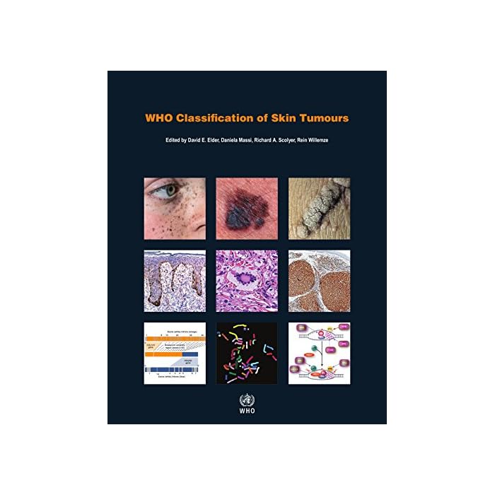 Buy WHO Classification of Skin Tumours: WHO Classification of Tumours ...