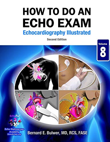 Amazon.com: How To Do An Echo Exam: Second Edition (Echocardiography ...