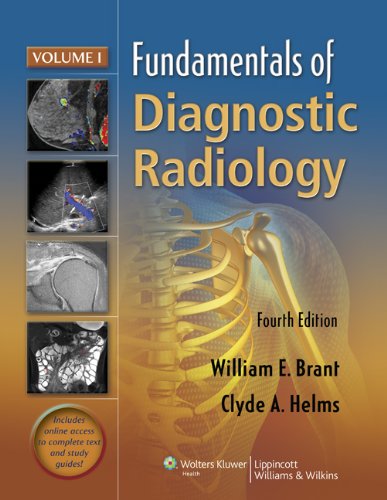 Fundamentals of Diagnostic Radiology - 4 Volume Set : Brant, William E ...