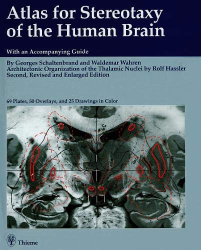 Atlas for Stereotaxy of the Human Brain: 9783133937023: Medicine ...