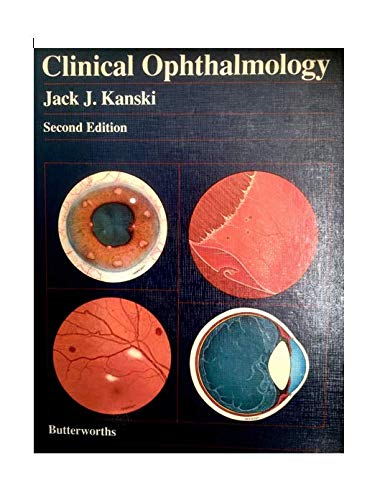 Amazon.com: Clinical ophthalmology: A systematic approach ...