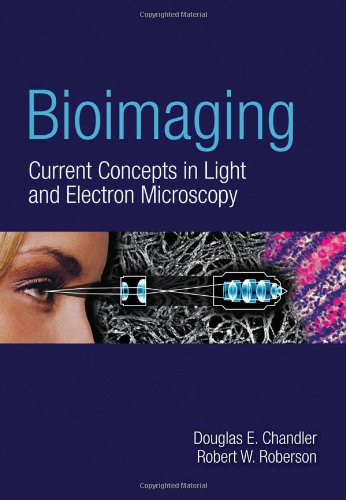 Bioimaging: Current Concepts in Light and Electron Microscopy ...