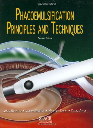 Phacoemulsification: Principles and Techniques: 9781556426049: Medicine ...