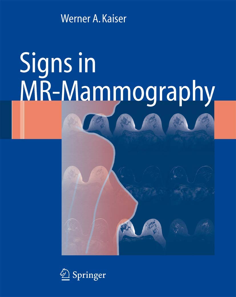 Signs in MR-Mammography: 9783540732921: Medicine & Health Science Books ...