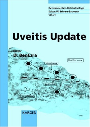 Uveitis Update (Developments in Ophthalmology): 9783805568913: Medicine ...