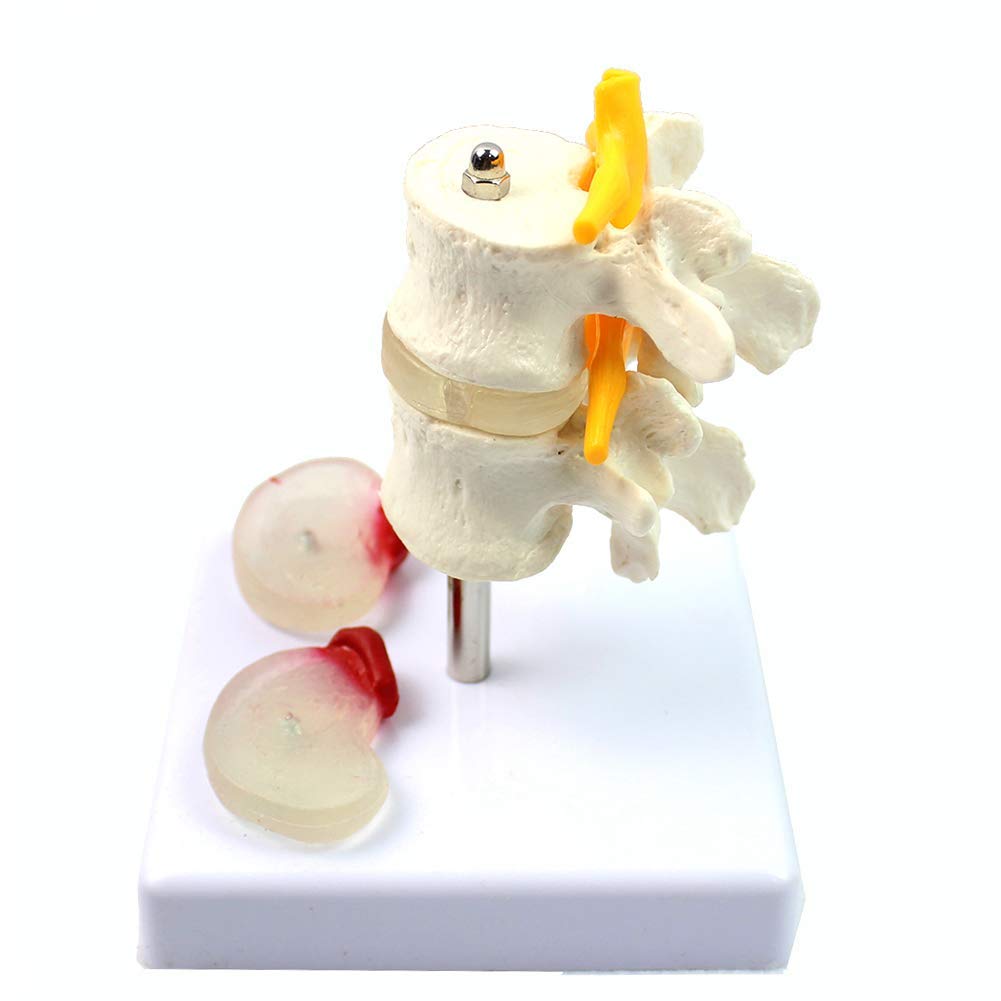 Human Spine Model Detachable Medical Teaching Model Lumbar Spine 2 ...