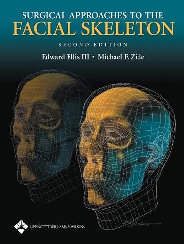 Amazon | Surgical Approaches to the Facial Skeleton | Ellis, Edward ...