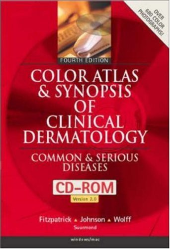 Color Atlas & Synopsis of Clinical Dermatology: Common & Serious ...