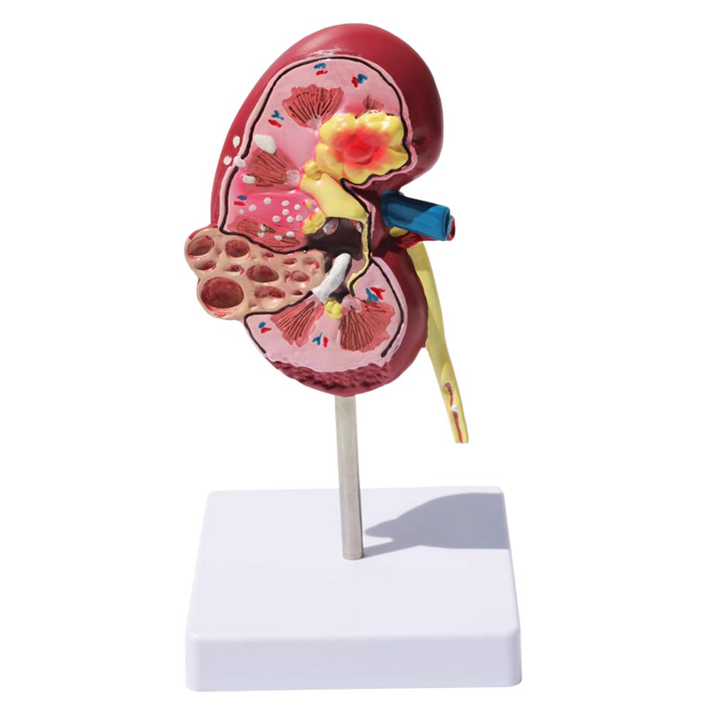 Liuu Human Kidney Model Kidney Model Anatomical Anatomy Human Kidney ...