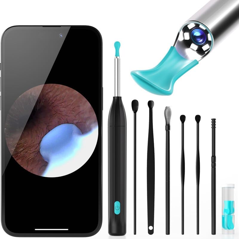 Amazon.com: Ear Wax Removal with Camera and Light: AILE Rechargeable ...