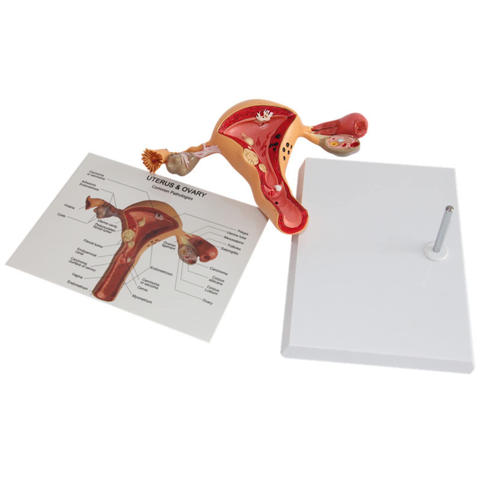 Uterus Anatomy Cadaver Solved] . Question 1 1 Select From The Options