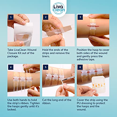 Snapklik.com : (6 CT) 1 X 3.7 Wound Closure Strips - Zip Stitch Wound ...