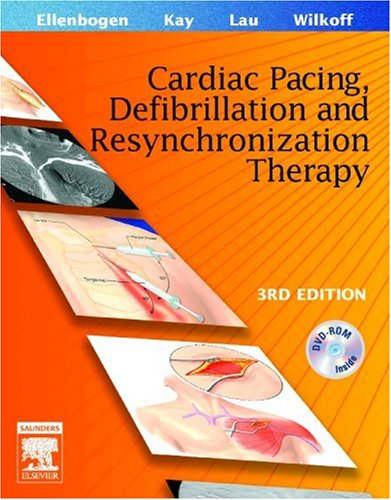 Clinical Cardiac Pacing, Defibrillation and Resynchronization Therapy ...