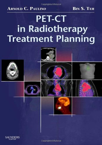 PET-CT in Radiotherapy Treatment Planning: 9781416032243: Medicine ...