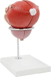 Amazon.com: MGUOTP Anatomical Models Enlarged Bladder Model Prostate ...