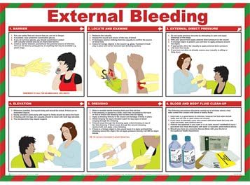 Safety First Aid External Bleeding A2 Poster, Laminated – BigaMart