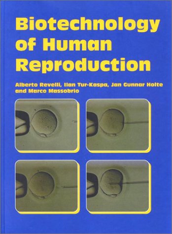 Biotechnology of Human Reproduction: 9781842141328: Medicine & Health ...