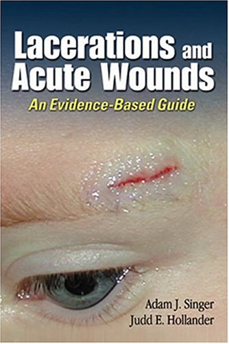 Buy Lacerations and Acute Wounds: An Evidence-Based Guide Book Online ...