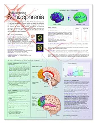 Understanding Schizophrenia Anatomical Chart : Anatomical Chart Company: Amazon.com.be: Livres