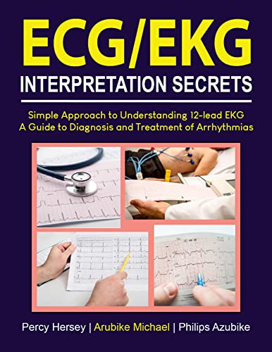 ECG/EKG INTERPRETATION SECRETS: Simple Approach to Understanding 12 ...