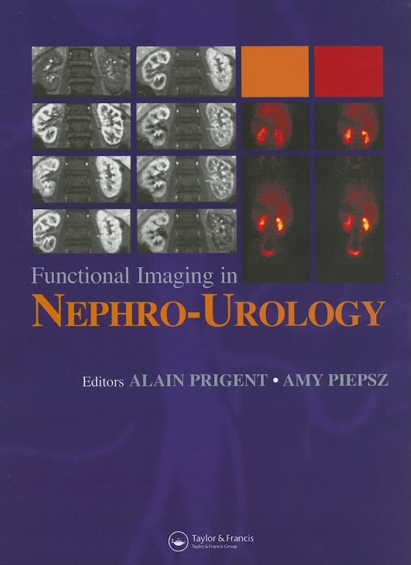 Functional Imaging in Nephro-Urology: 9781841845111: Medicine & Health ...