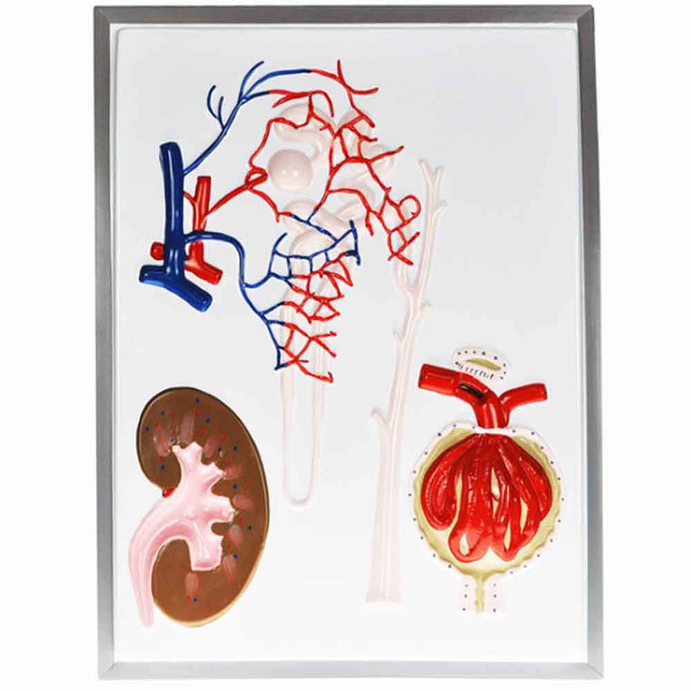 Buy Human Anatomy Magnification Model - Kidney Anatomy Model for ...