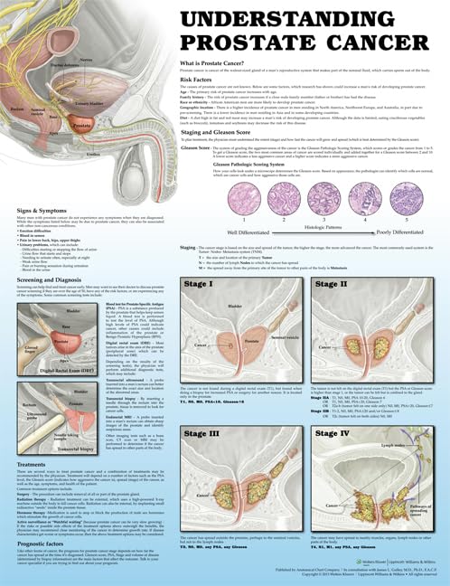 Understanding Prostate Cancer Paper : Anatomical Chart Company, Gulley ...