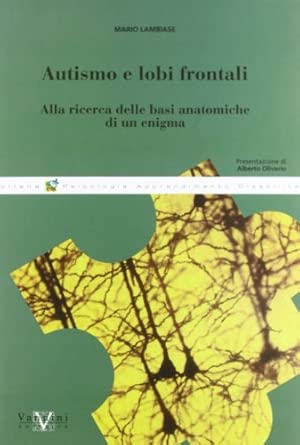 Amazon.com: Autismo e lobi frontali: 9788874360246: Books