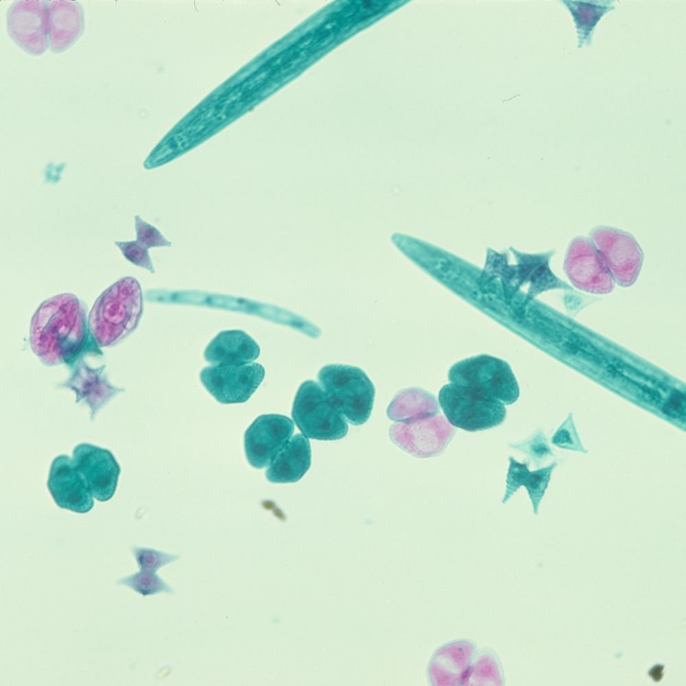 Desmids Under Microscope