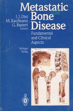 Metastatic Bone Disease: Fundamental and Clinical Aspects : Amazon.in ...