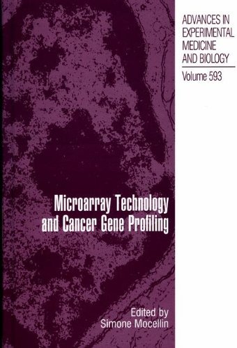 Amazon.co.jp: Microarray Technology and Cancer Gene Profiling (Advances ...