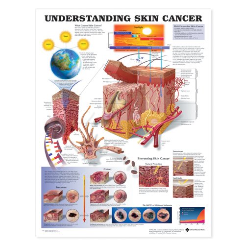 Amazon | Understanding Skin Cancer Anatomical Chart | Anatomical Chart ...