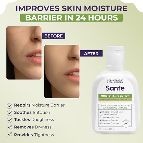 Sanfe Moisturising Lotion | Improves skin moisture barrier in 24 hours ...