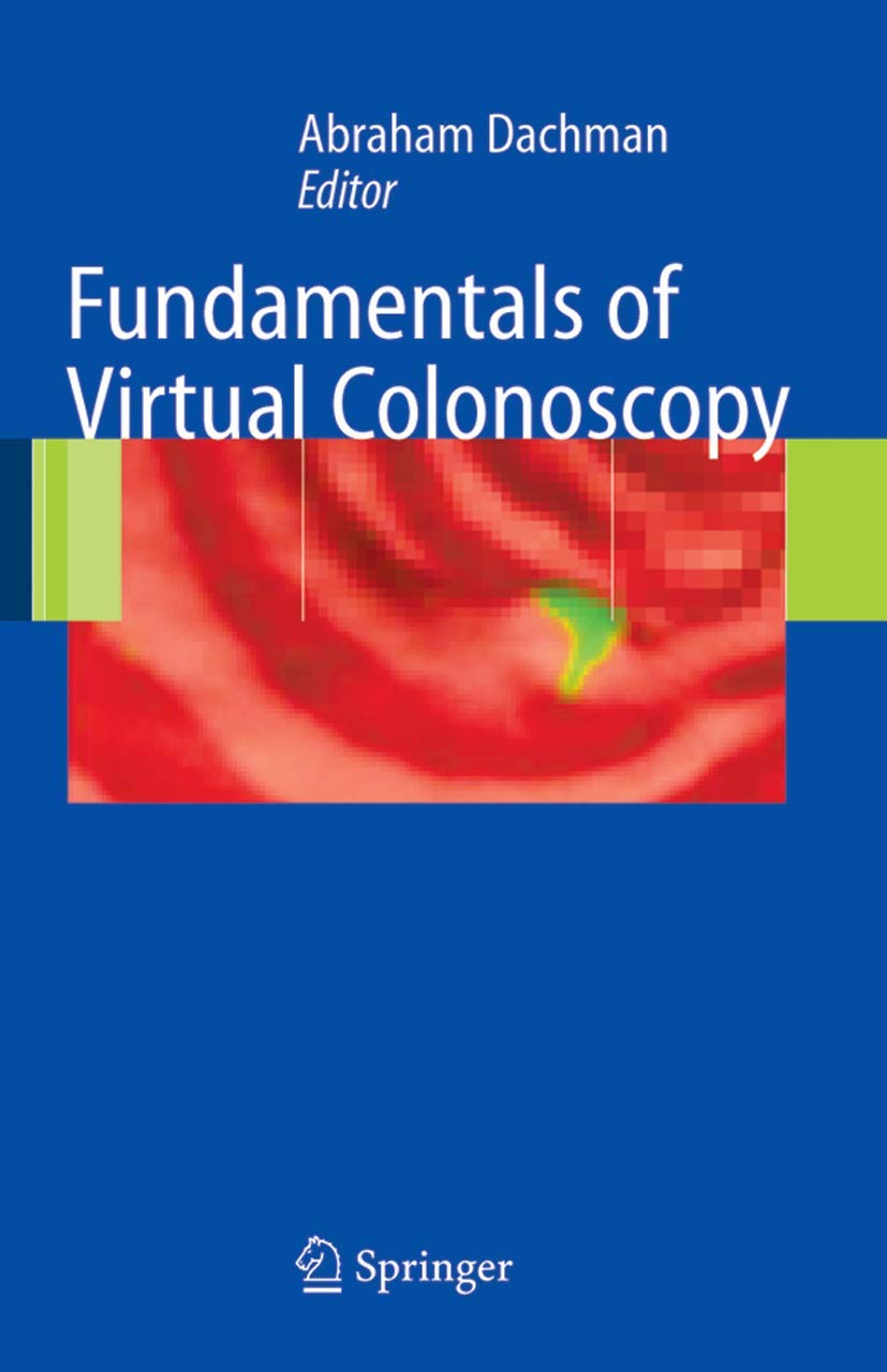 Fundamentals of Virtual Colonoscopy: 9780387219127: Medicine & Health ...