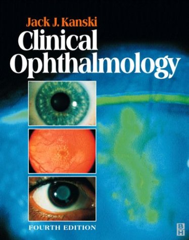 Amazon | Clinical Ophthalmology: A Systematic Approach | Kanski MD MS ...