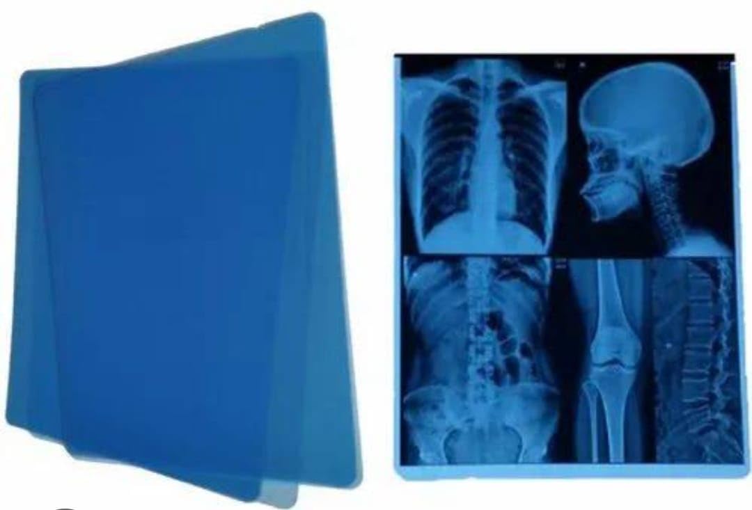 Sai Healthcare High-Resolution Dry X-Ray Film (Blue Base) - 100 Sheets ...